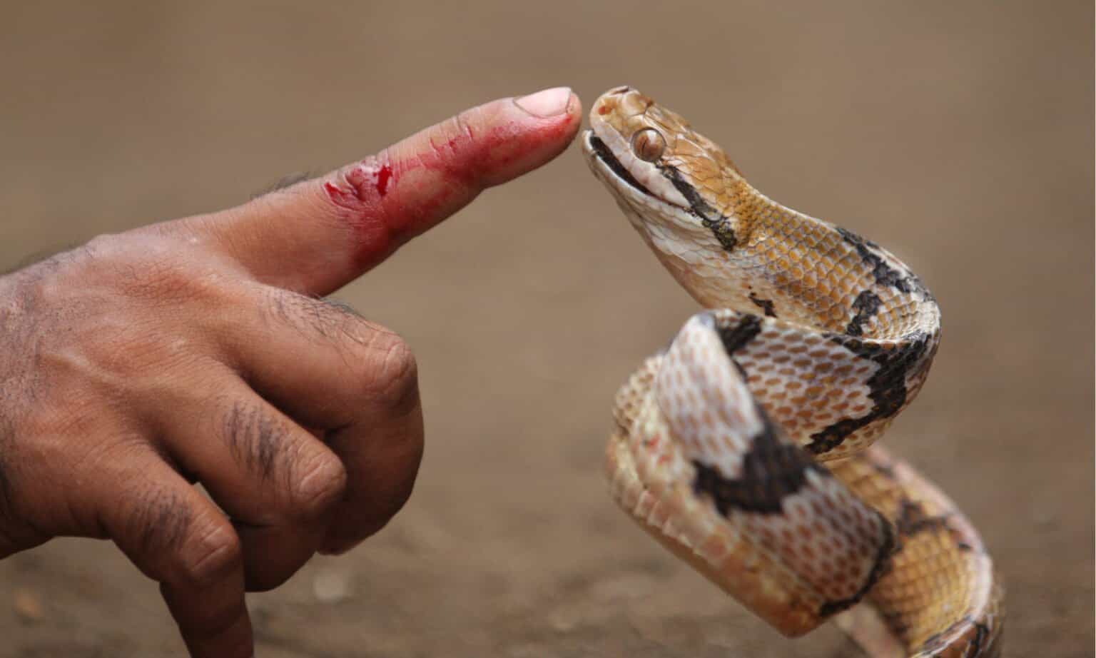 Why You Should Never Treat a Snake Bite at Home - A-Z Animals