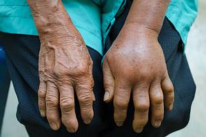 Asp Animal Facts - Vipera aspis - A-Z Animals