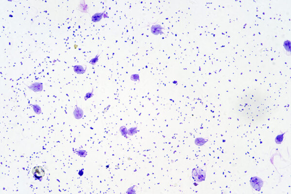 These Terrifying Parasites Feed on Humans - A-Z Animals