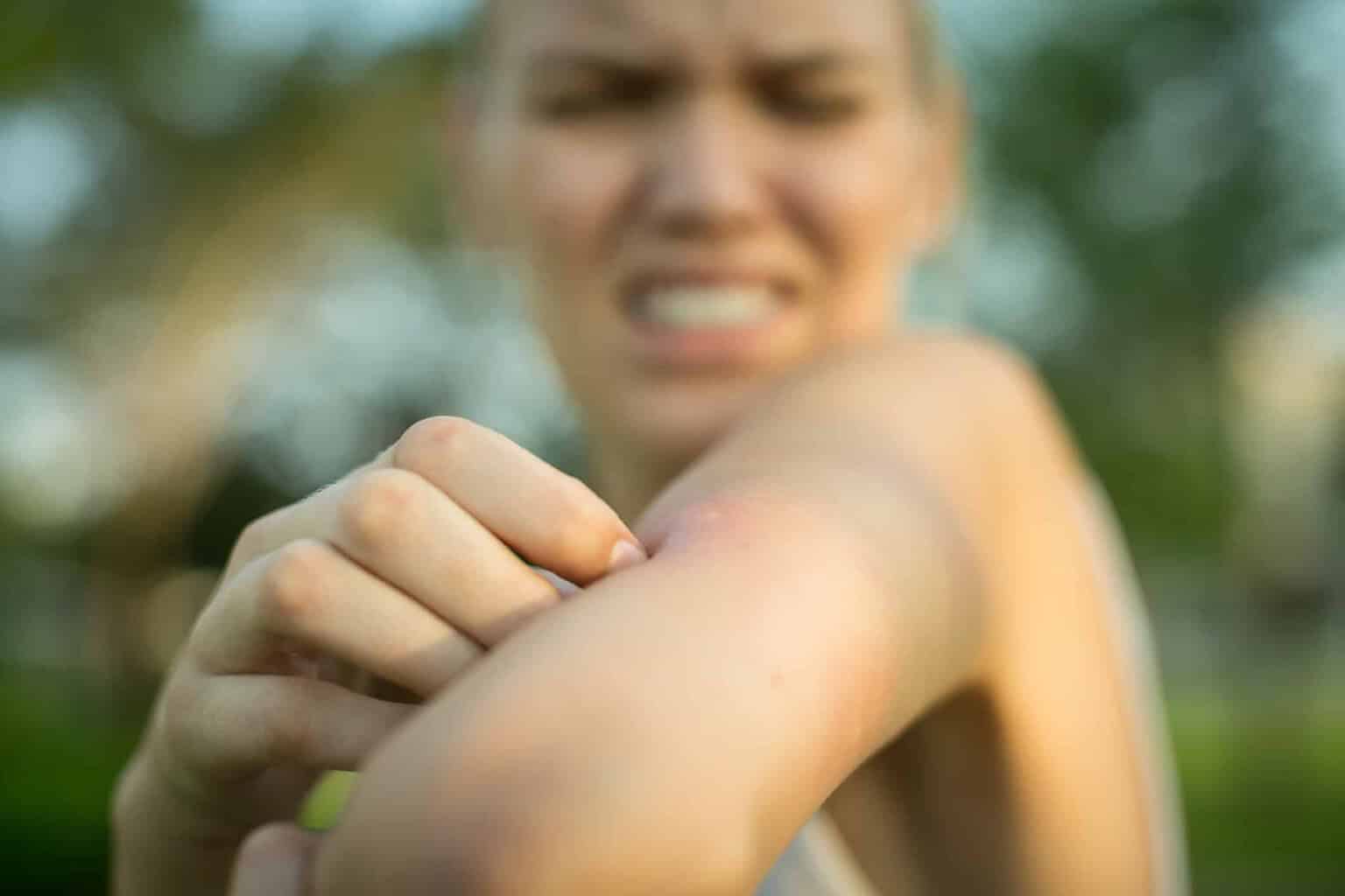 This Insect Kills More Than a Million People Each Year - A-Z Animals