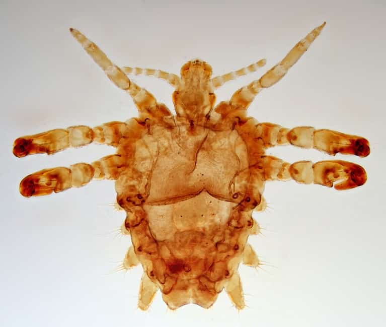 13 Living Creatures Found on the Human Body - A-Z Animals